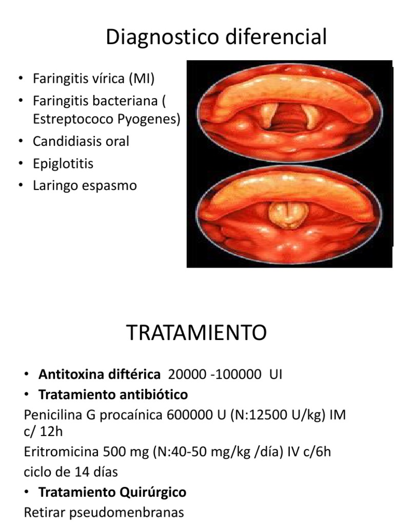 Diapositivas Difteria | PDF | Inmunología | Rtt