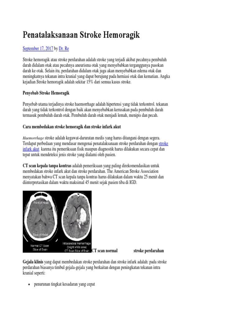 Penatalaksanaan Stroke Hemoragik | PDF