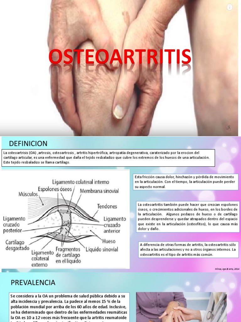 Osteoartritis Artrosis | PDF | Osteoartritis | Cartílago