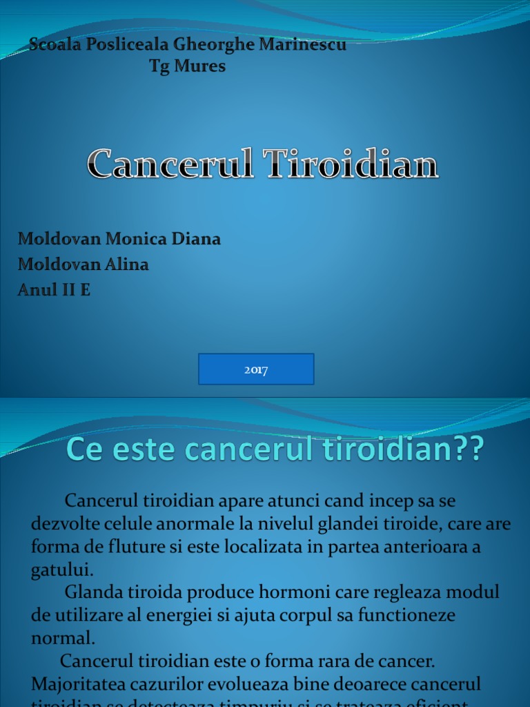 Cancerul Tiroidian | PDF