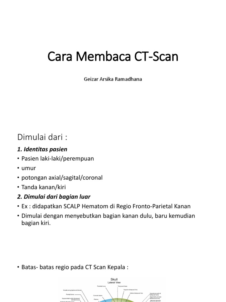Cara Membaca CT-Scan | PDF