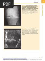 Lesiones Básicas. Osteofitos (Clases), Sindesmosfitos, Entesofitos ...