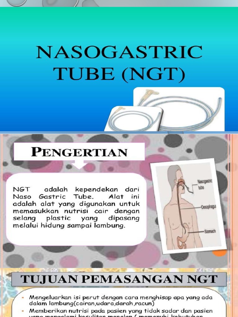 PTT SOP NGT | PDF
