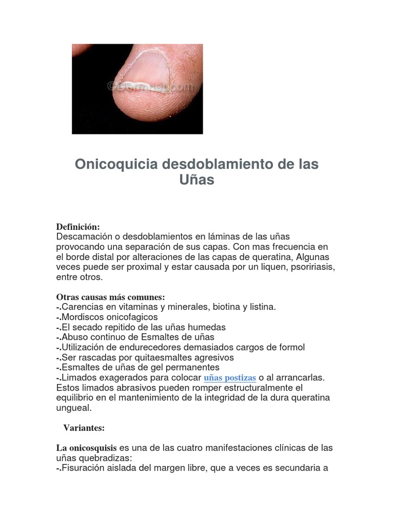 Onicoquicia Desdoblamiento de Las Uñas | PDF | Clavo (anatomía ...
