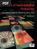 Congestive Heart Failure and Pulmonary Edema Concept Map | PDF | Heart ...