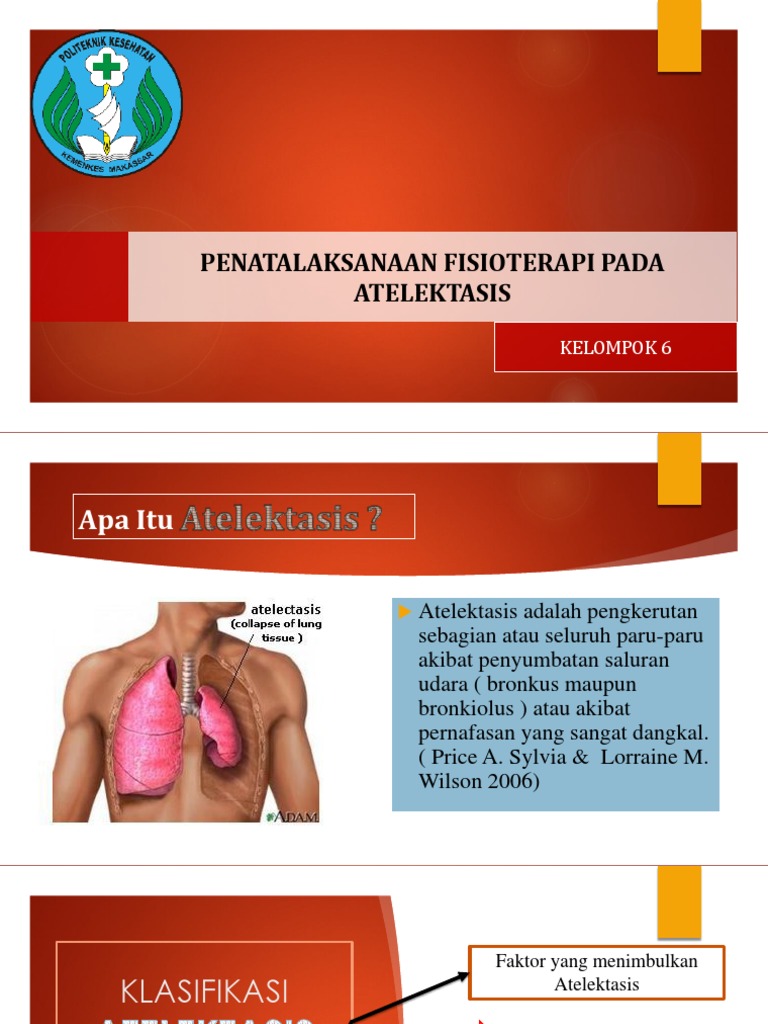 Penatalaksanaan Fisioterapi Pada Atelektasis | PDF