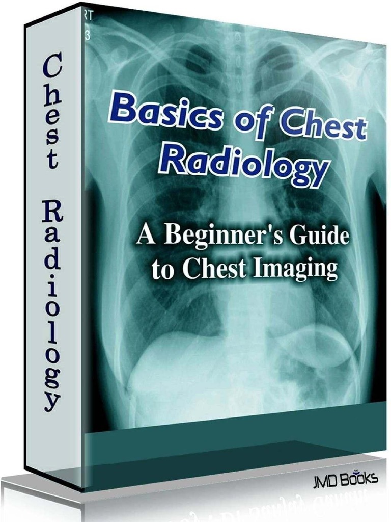Basics of Chest Radiology - New Edition - DR H. Davies (Contributing Author) | PDF | Aorta | Lung