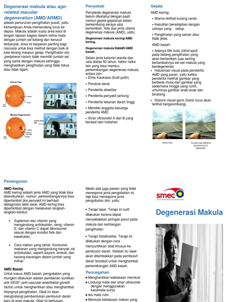 Leaflet Degenerasi Makula - RS Mata SMEC | PDF