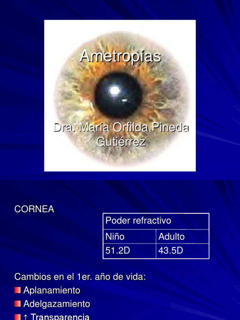 Principales defectos refractivos: miopía, hipermetropía, astigmatismo y ...
