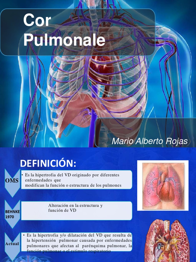 Cor Pulmonale | PDF | Hipertensión | Insuficiencia cardíaca