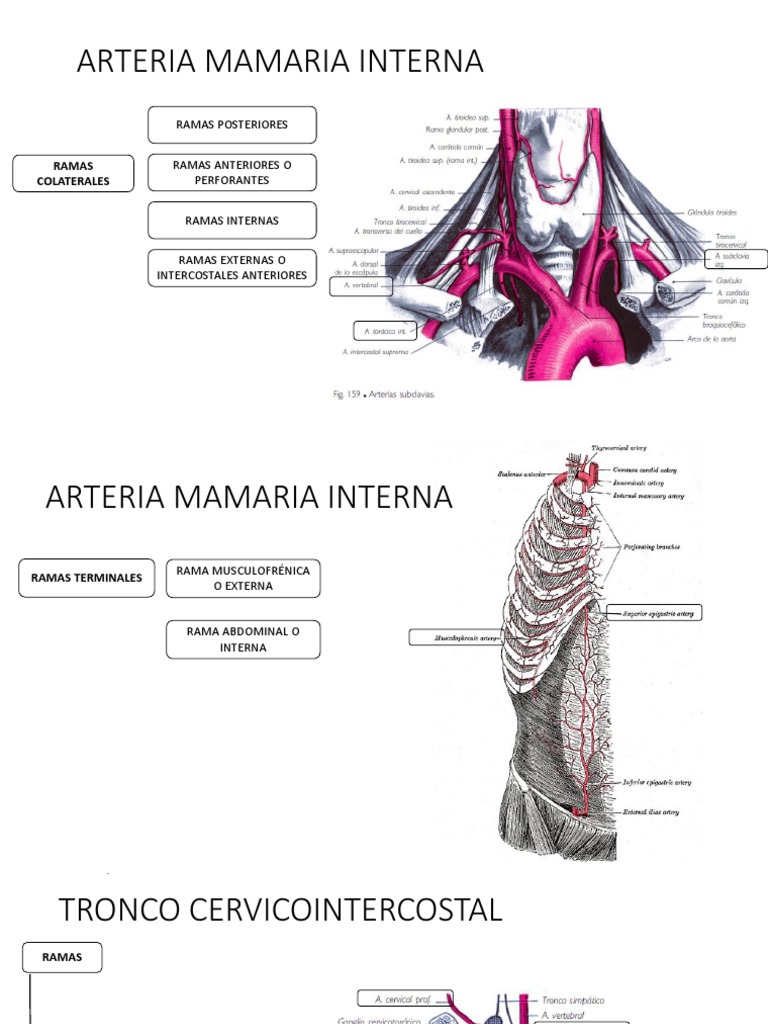 Anatomía De La Arteria Mamaria Interna Cirugía Coronaria Con Doble