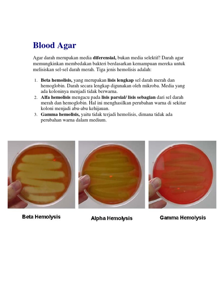 Blood Agar