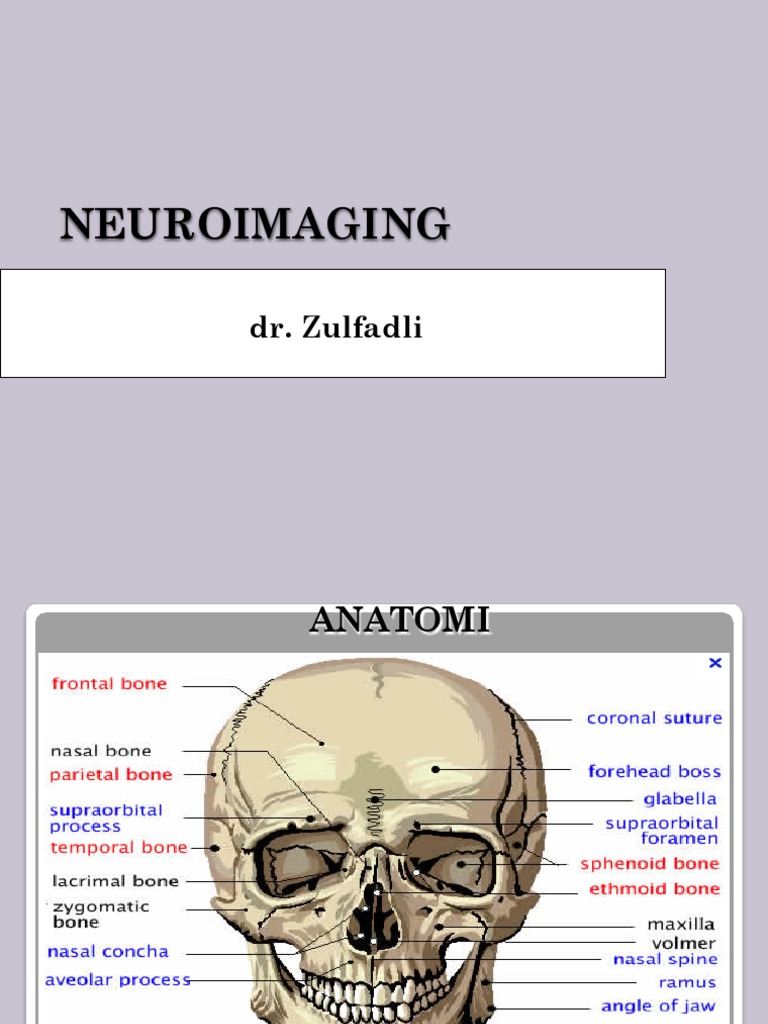 Neuroimaging PDF | PDF