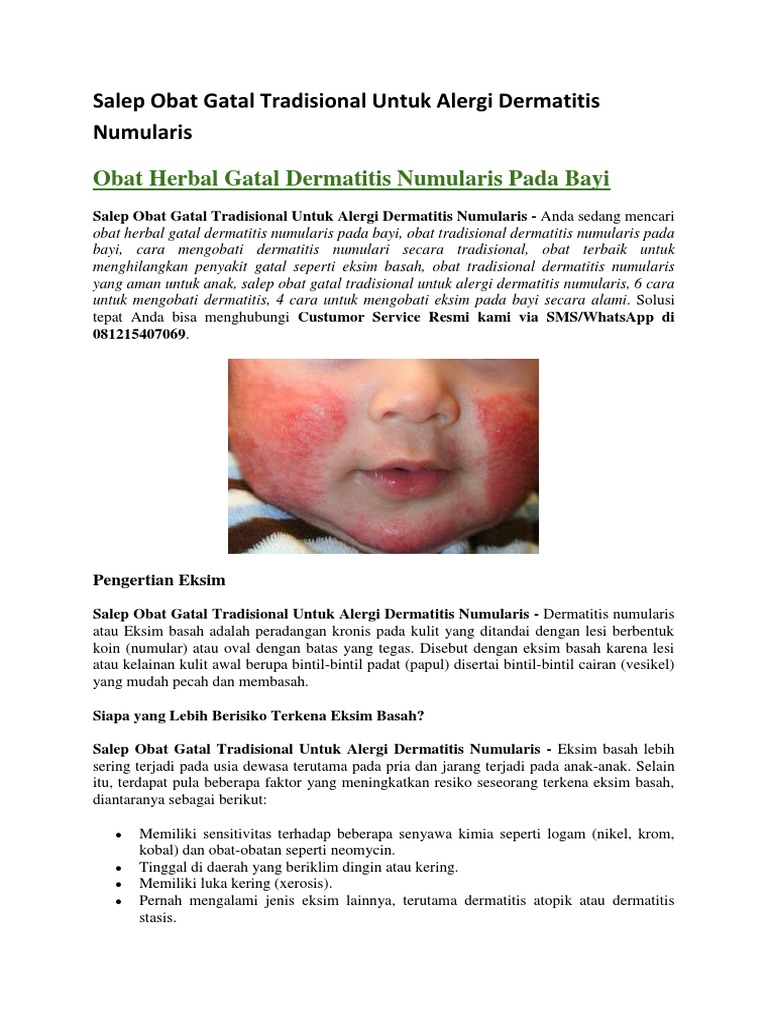 Salep Obat Gatal Tradisional Untuk Alergi Dermatitis Numularis | PDF