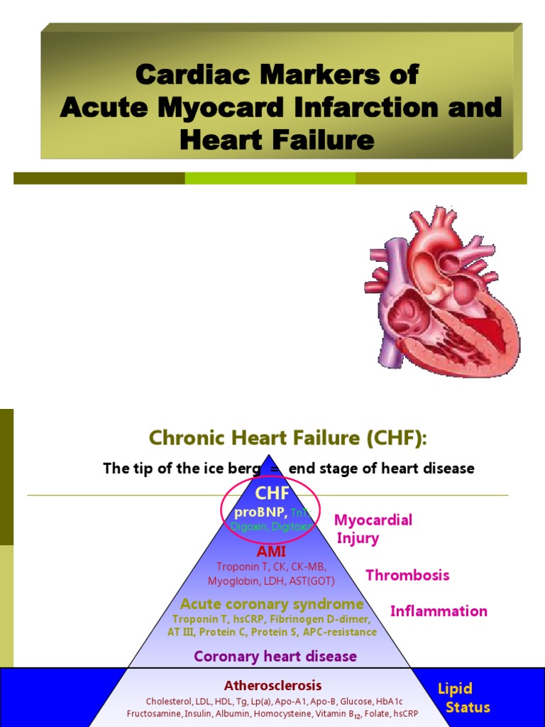 Cardiac Markers of Acute Myocard Infarction and Heart Failure | PDF