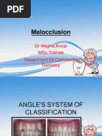 Canine Occlusion Classification Overview | PDF | Social Science | Young ...