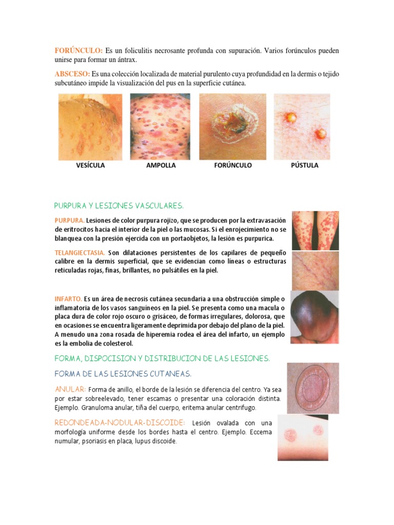 Lesiones Primarias | PDF | Piel | Lupus eritematoso sistémico
