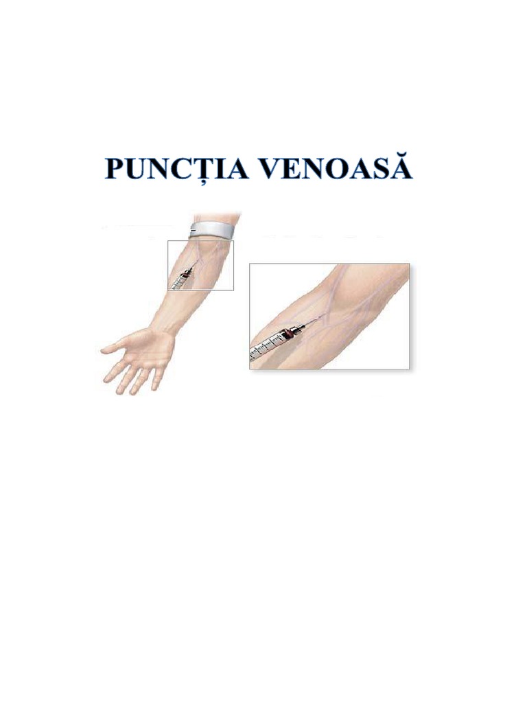 Punctia Venoasa | PDF