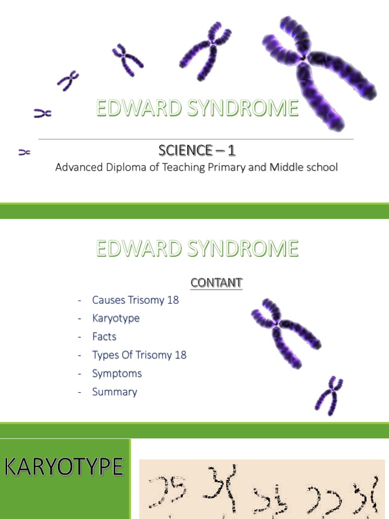 Edward Syndrome Ppt | Genetics | Human Diseases And Disorders | Free 30 ...
