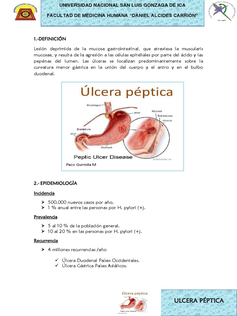 ulceras-PEPTICA | Enfermedades y trastornos | Especialidades Medicas
