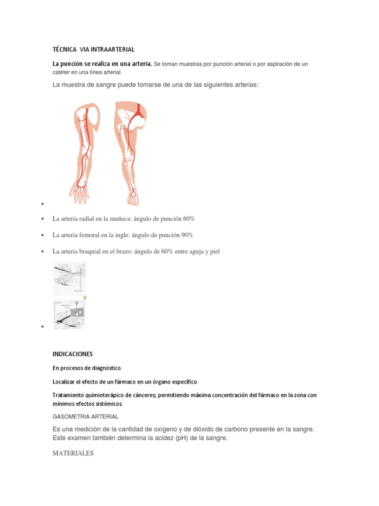 Técnica Via Intraarterial | PDF | Medicina | Medicina CLINICA