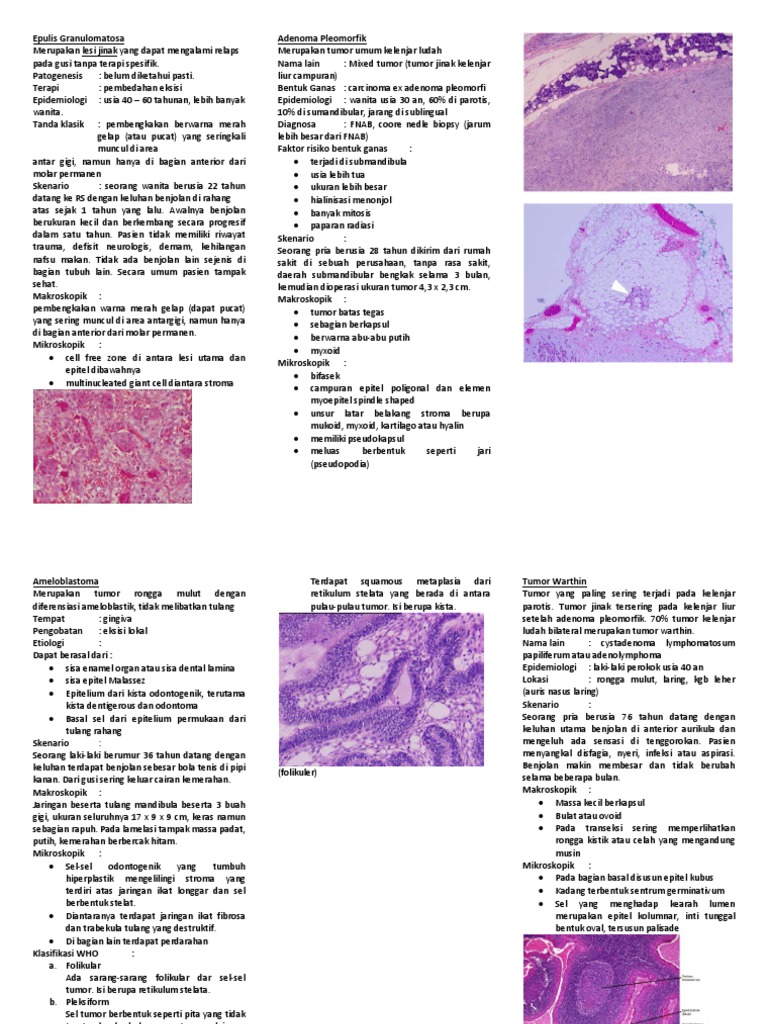 Epulis Granulomatosa | PDF