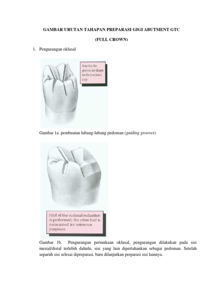 Gambar Urutan Tahapan Preparasi Gigi Abutment GTC | PDF