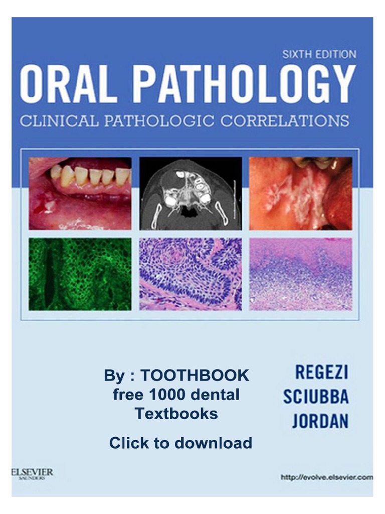 Oral Pathology- Clinical Pathologic Correlations - 6th.ed | Medical ...