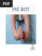 Pie Talo, Pie Varo, Valgo, y Pie Plano | PDF | Pie | Tobillo