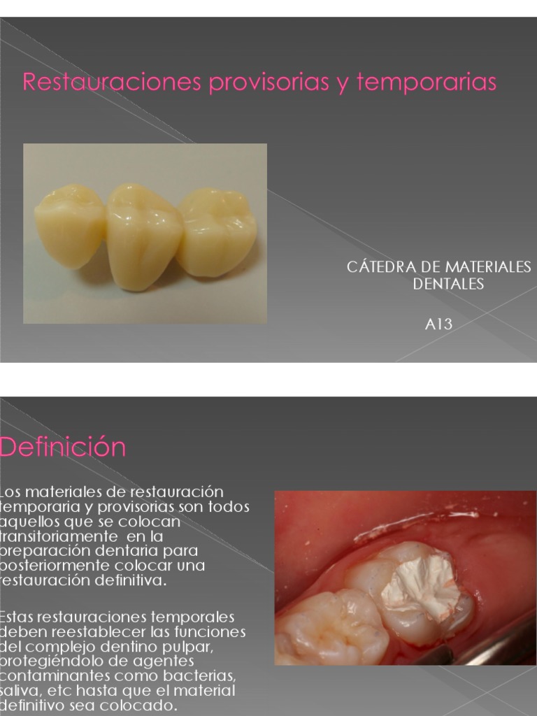 3 Obturaciones Temporarias ZOE, CAVIT y PROVISORIOS | PDF | Zinc ...