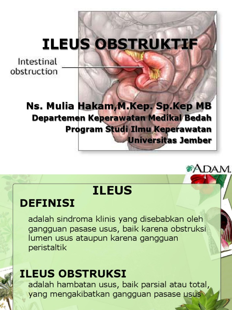 Ileus Obstruktif: Patofisiologi, Etiologi, Gejala, dan Penatalaksanaan ...