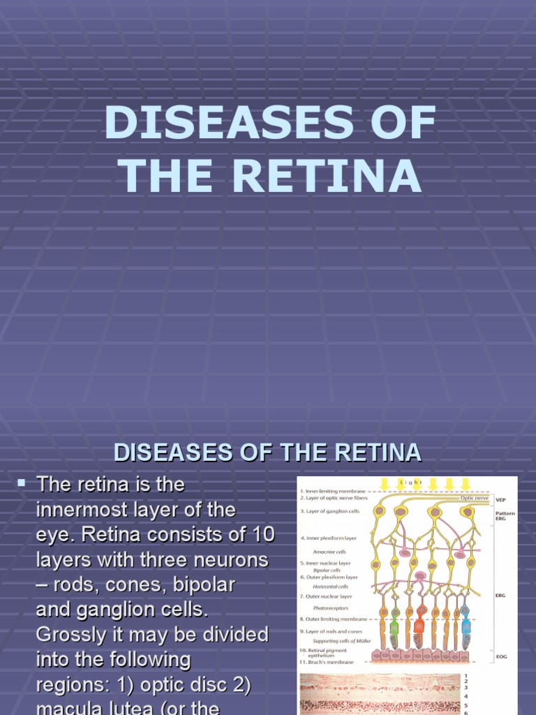 Understanding Retina Diseases and Treatments | PDF | Retina | Medical ...