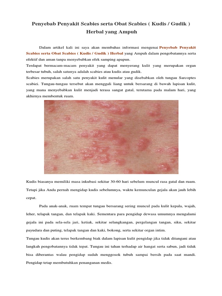Penyebab Penyakit Scabies Serta Obat Scabies | PDF