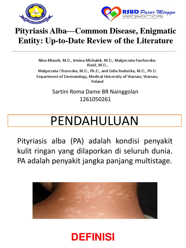 Pityriasis Alba-Common Disease, Enigmatic | PDF