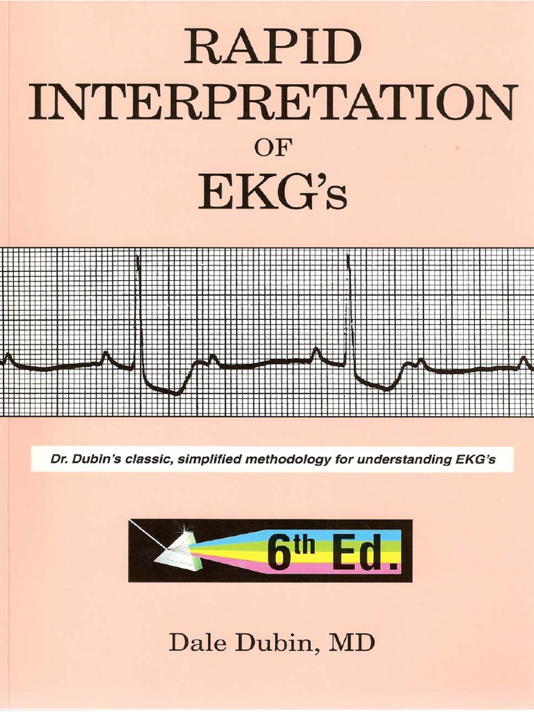 Dubin Ecg