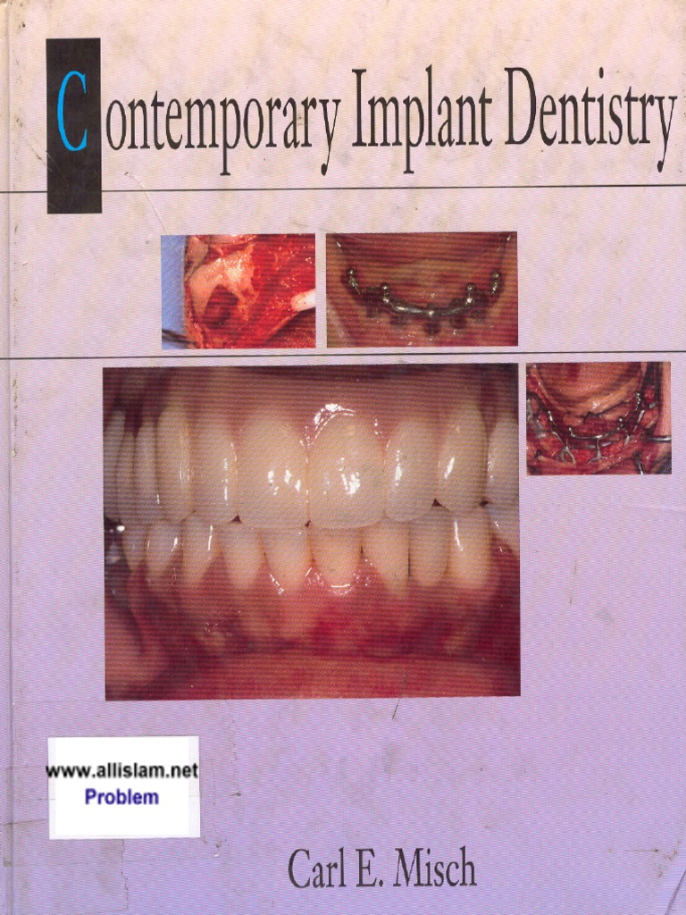 Contemporary Implant Dentistry PDF | PDF