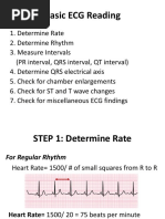 Sgarbossa Criteria - LITFL - ECG Library Diagnosis | PDF | Electrocardiography | Myocardial ...
