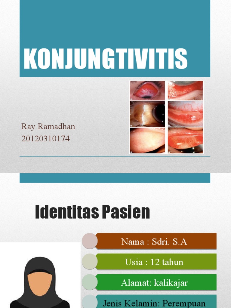 Diagnosis dan Pengobatan Konjungtivitis | PDF