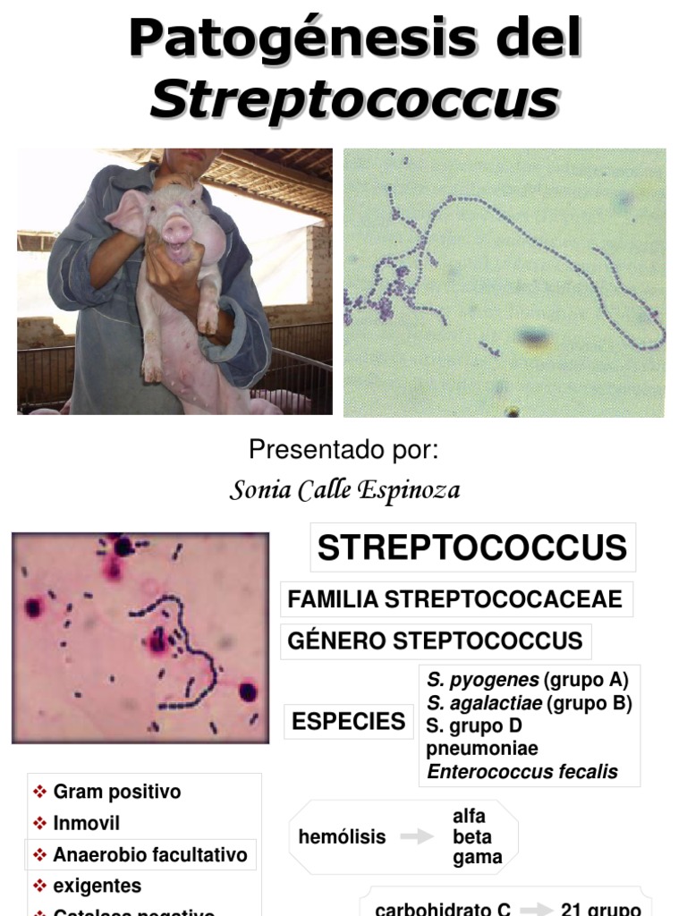 Streptococcus: Sonia Calle Espinoza | Estreptococo | Meningitis