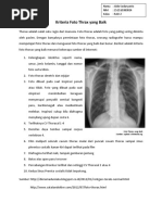 Thorax PA, AP Dan Lateral, RLD Dan LLD | PDF