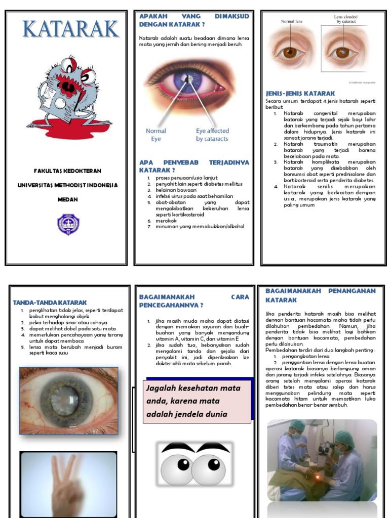 Understanding Cataracts: Causes, Symptoms, Prevention and Treatment | PDF
