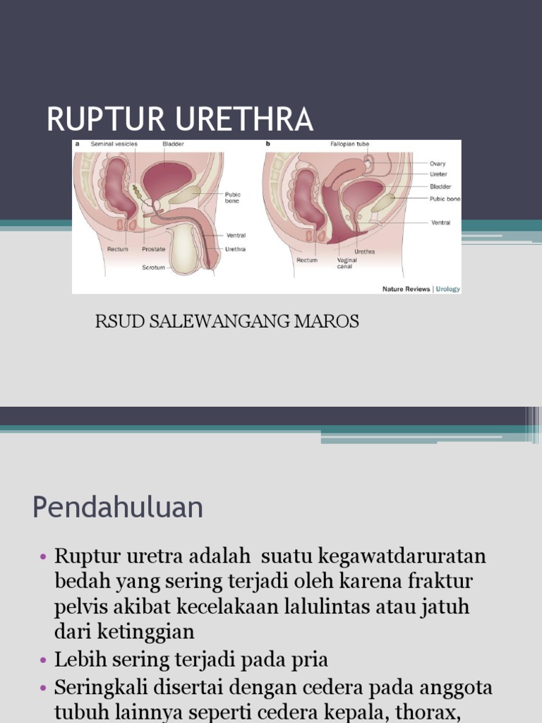 Penatalaksanaan Ruptur Uretra | PDF