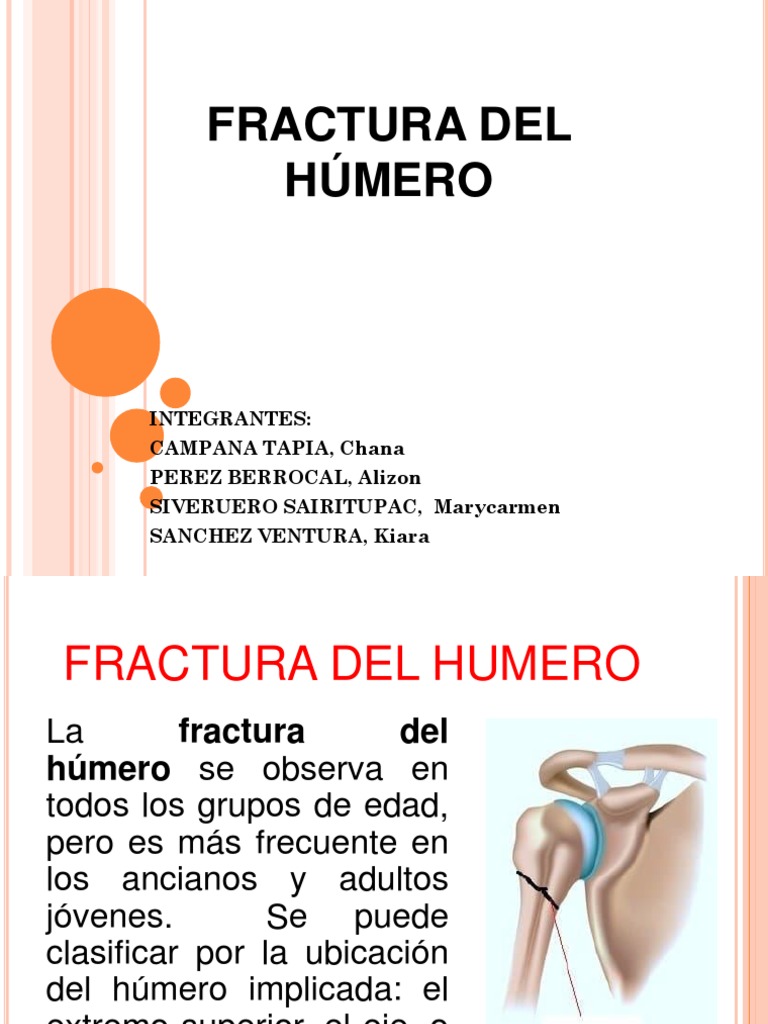 Fractura Del Húmero | PDF | Hombro | Codo