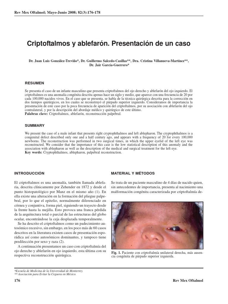 Criptoftalmos y Ablefarón. Presentación de Un Caso. | PDF | Ojo humano ...