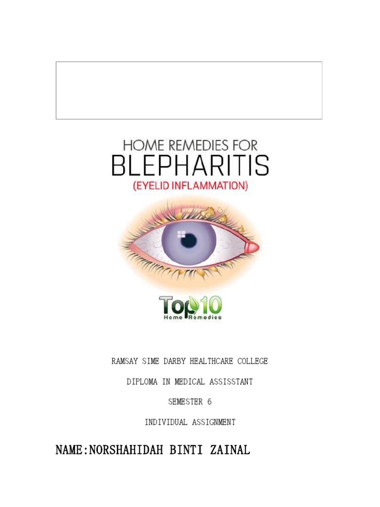 Case Study Blepharitis | Immunology | Medical Specialties