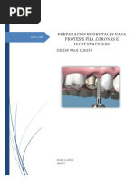 Técnica de Arco Segmentado Burstone | PDF | Diente | Odontología