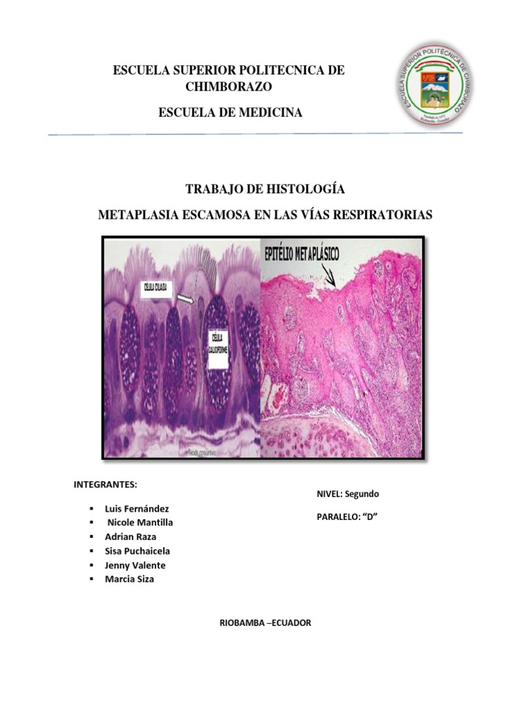 Metaplasia 1 | PDF | Epitelio | Diferenciación celular
