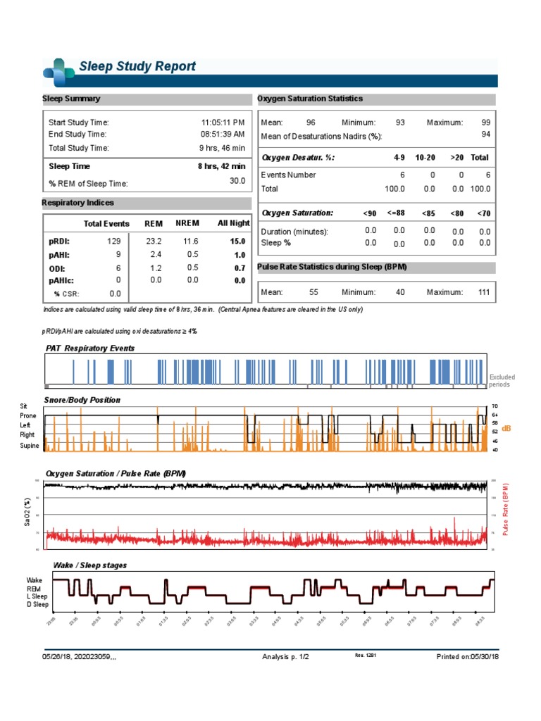 Sleep Study Report: Sleep Summary Oxygen Saturation Statistics | PDF