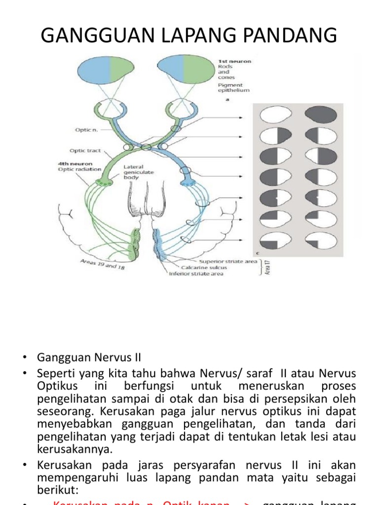 Gangguan Lapang Pandang | PDF