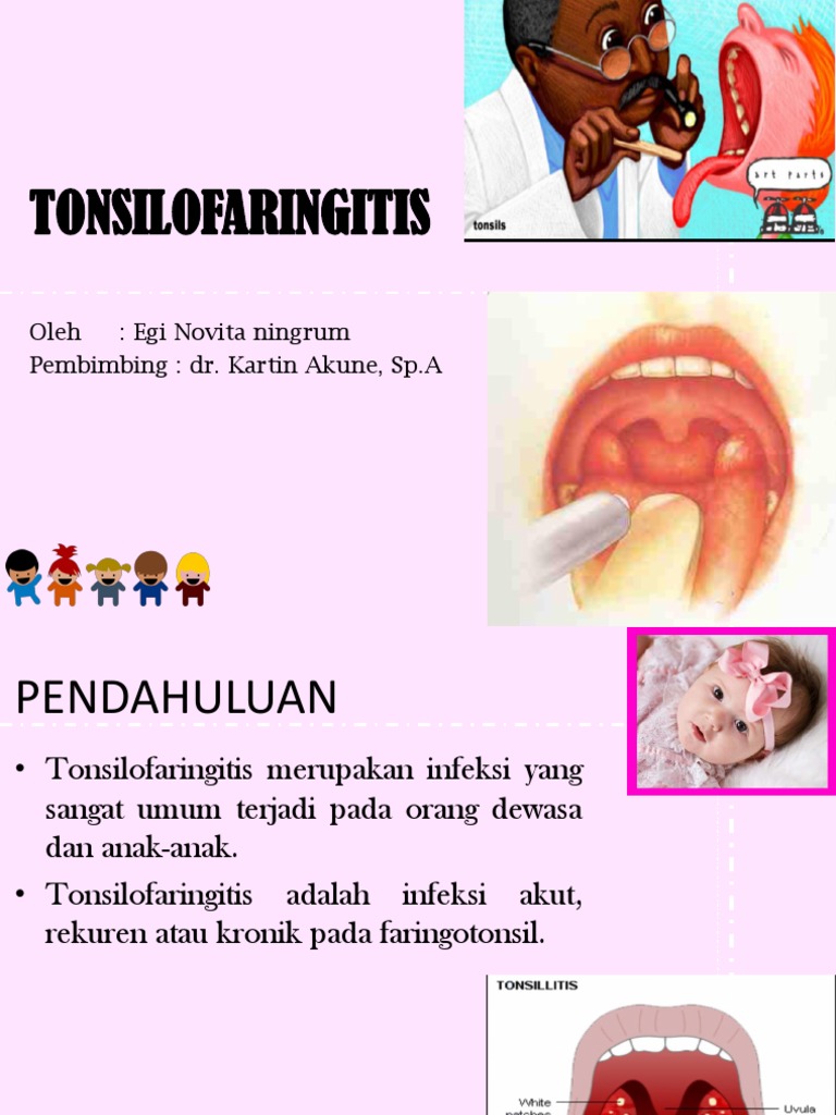 TONSILOFARINGITIS | PDF